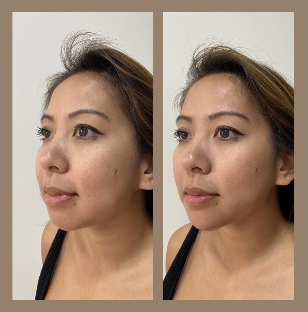 Elevating Aesthetic Medicine: Allison Lester, PA-C, at the Famed Shafer ...